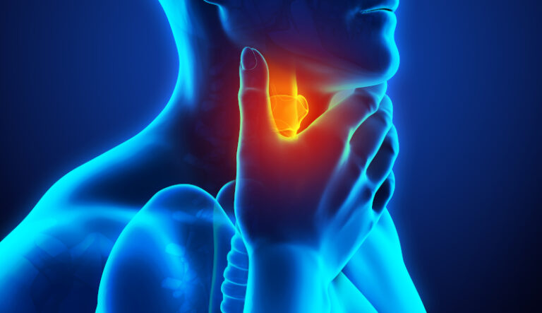 Diverticoli esofagei - La Nutrizione